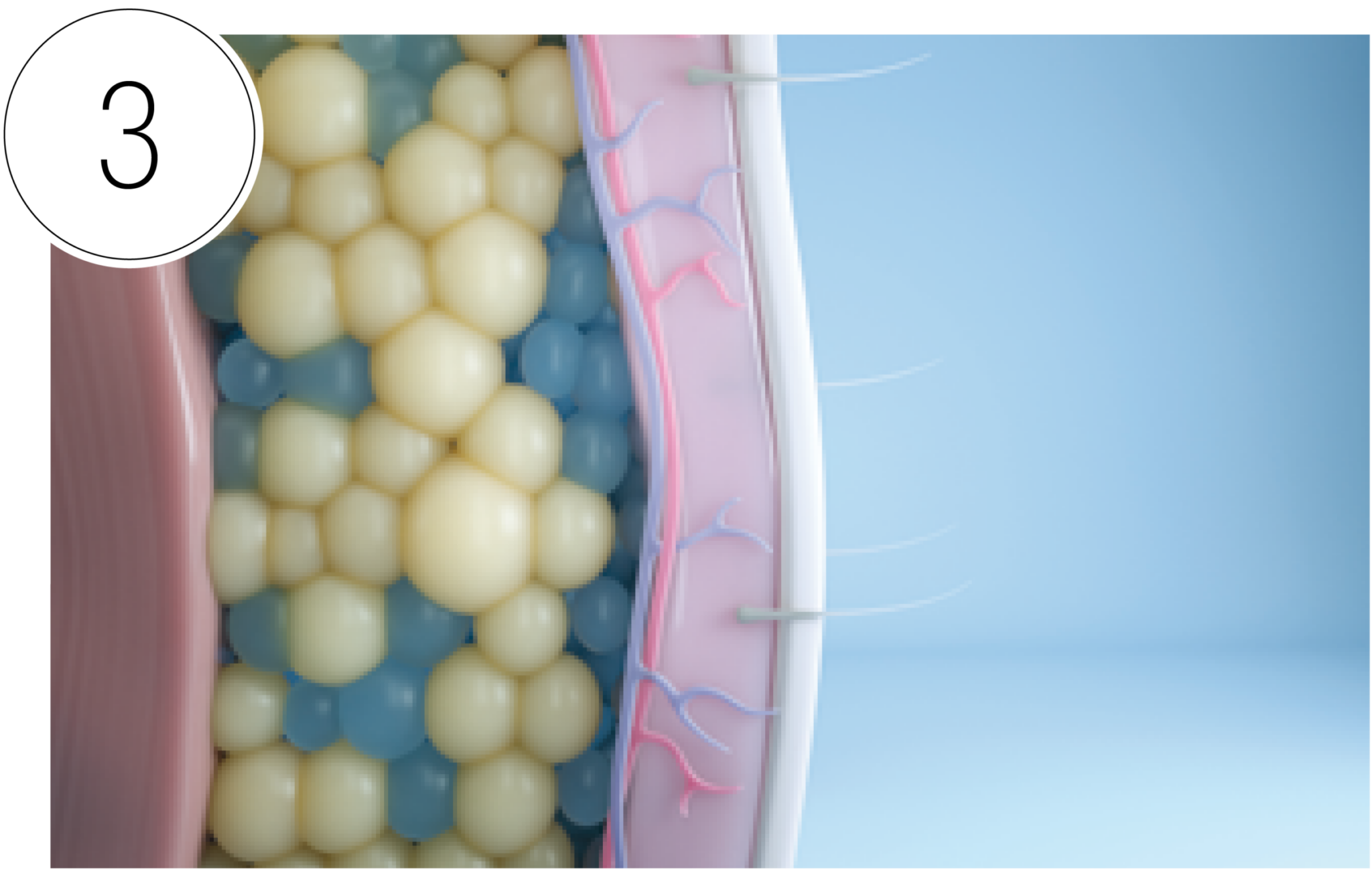 Coolsculpting Miami | Before & After Results | Get 50% Off